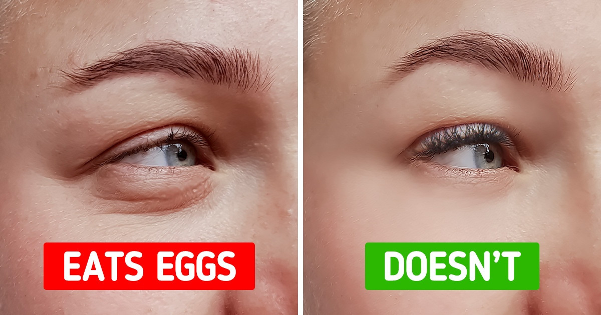 What Could Happen If You Stopped Eating Eggs Completely Bright Side What Could Happen If You Stopped Eating Eggs Completely Bright Side