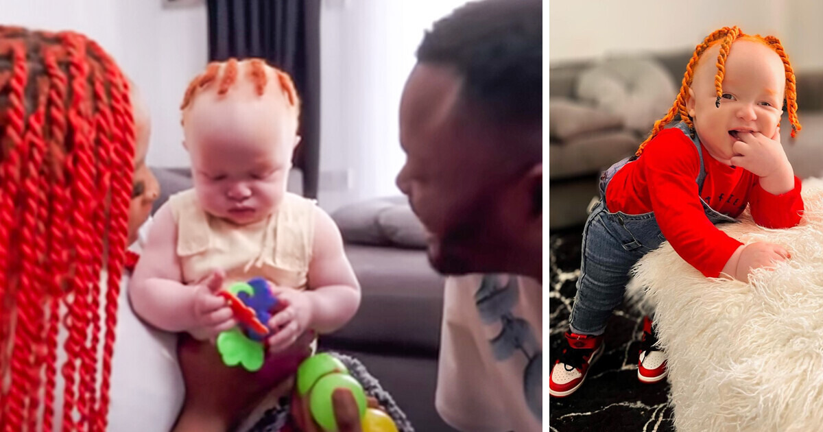 Black Mom With Ginger Albino Baby Reveals What She Does to Make Him ...