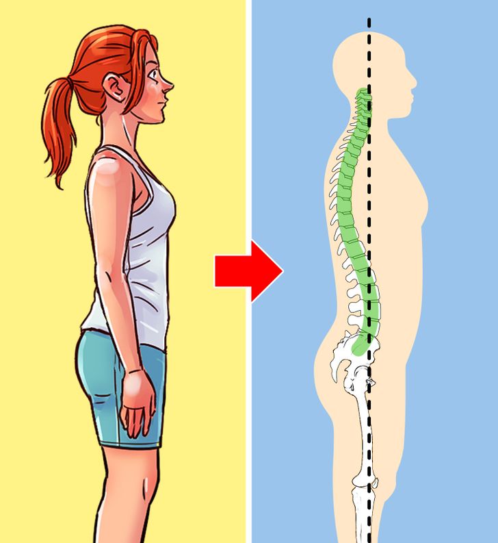 4 Types Of Poor Posture And How To Fix Each Of Them Bright Side